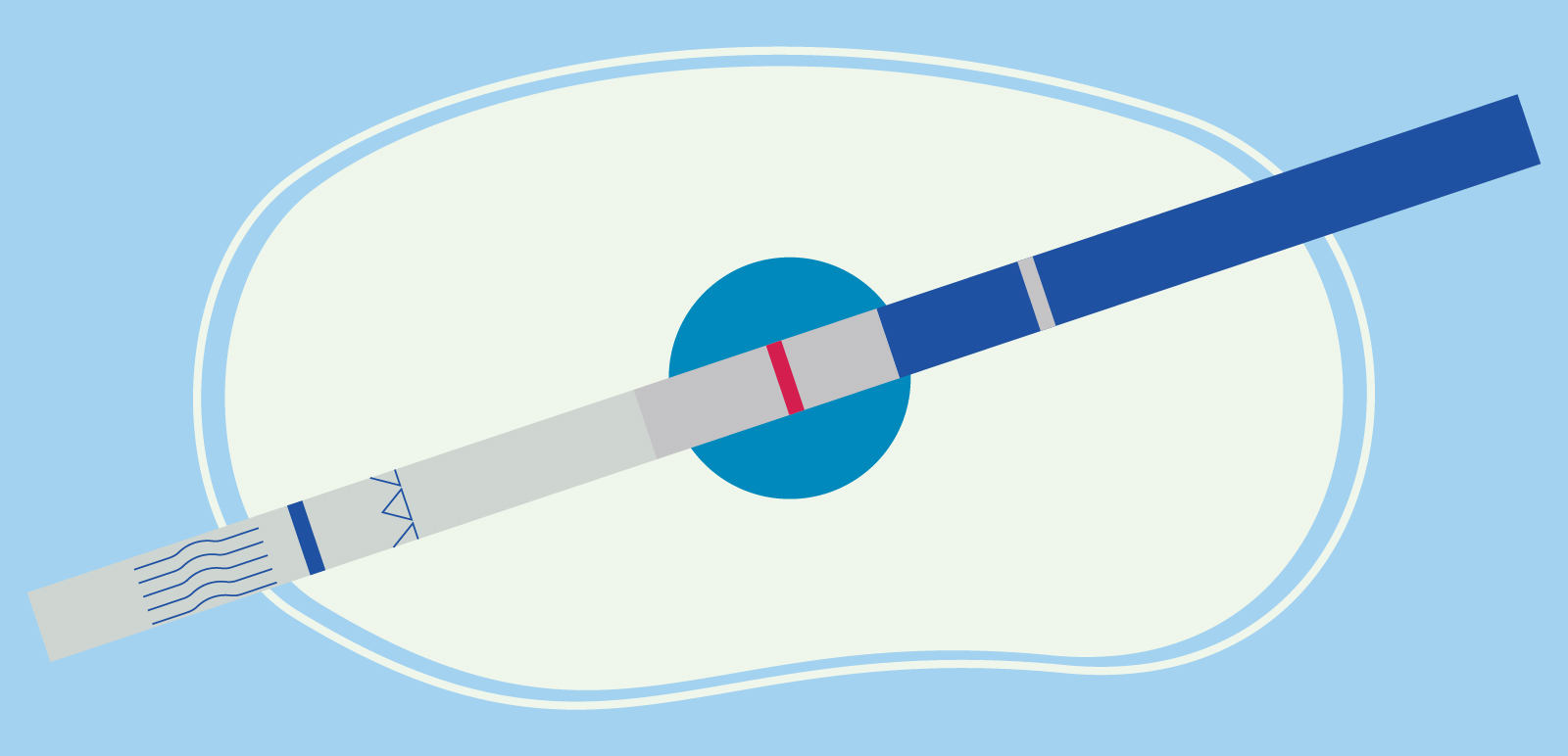 Fentanyl: Ano ito at Saan Makakahanap ng Paggamot - San Francisco Health Plan